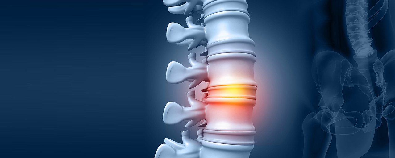 Axial Spondyloarthritis - Arthritis Resources for Healthcare ...